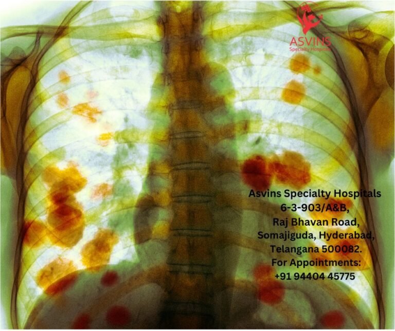Non-Small Cell Lung Cancer (NSCLC): Types, Treatments, and Prognosis ...