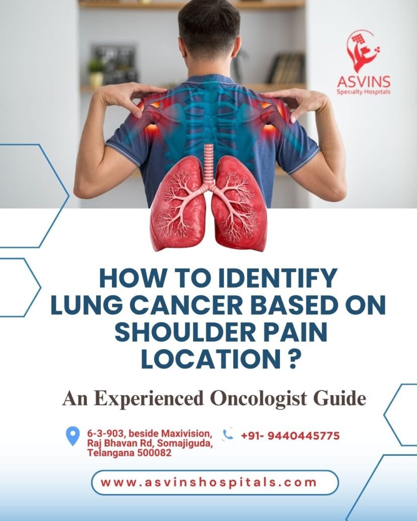 Experiencing shoulder pain? 🤔 It might be related to lung cancer ...