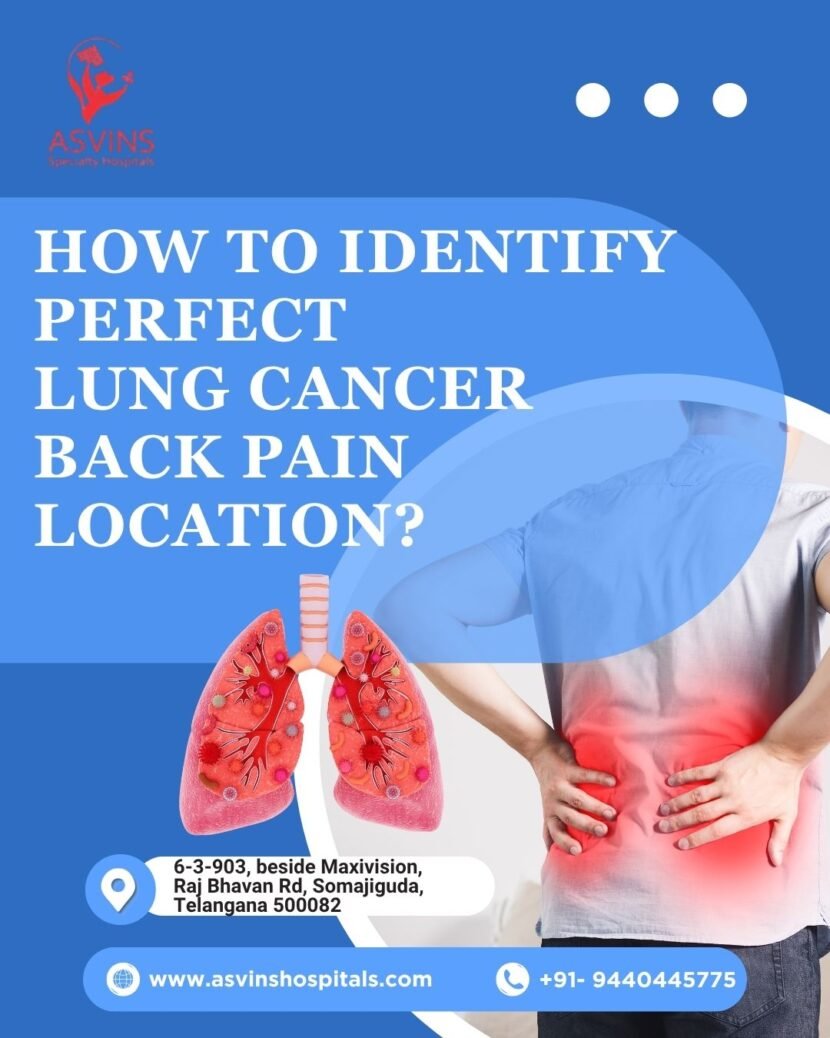 Best Lung Cancer Treatment Oncologist Doctor Hospital in Hyderabad
