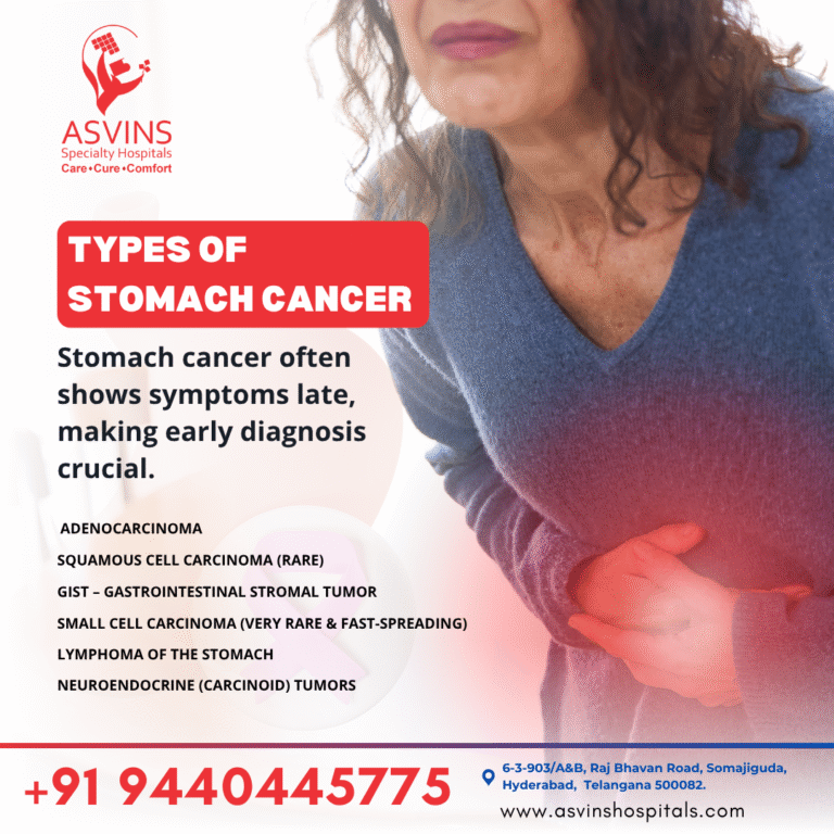Types of Stomach Cancer & Best Treatment in Hyderabad | Asvins ...